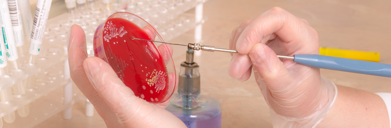 ΜΙΚΡΟΒΙΟΛΟΓΙΚΟ | Βασίλκα Μερεντίτη-Οικονόμου, Μικροβιολόγος-Βιοπαθολόγος